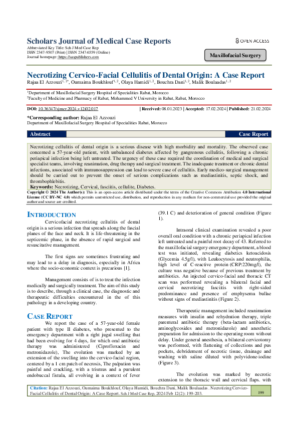 (PDF) Necrotizing Cervico-Facial Cellulitis of Dental Origin: A Case Report