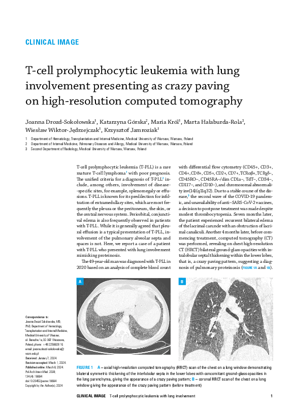 (PDF) T-cell prolymphocytic leukemia with lung involvement presenting ...