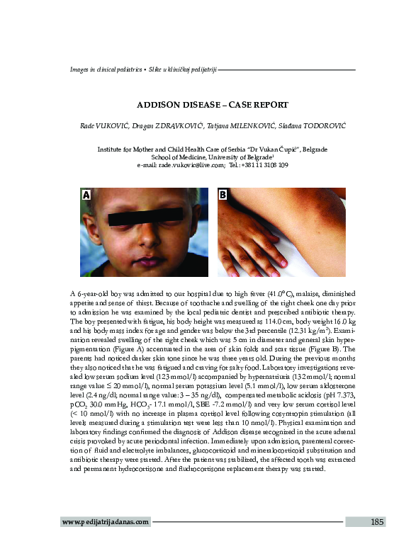 (PDF) Addison Disease - Case Report | Dragan Zdravković - Academia.edu