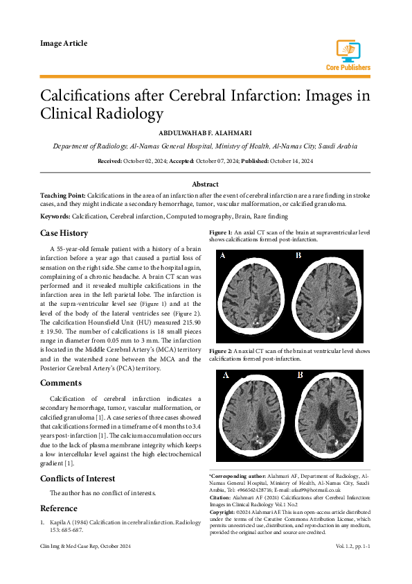 (PDF) Calcifications after Cerebral Infarction: Images in Clinical ...
