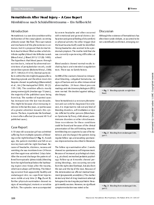 (PDF) Hematidrosis After Head Injury – A Case Report | Karel Spacil ...