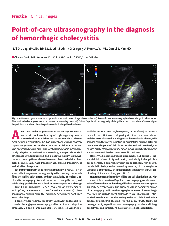 (PDF) Point-of-care ultrasonography in the diagnosis of hemorrhagic ...