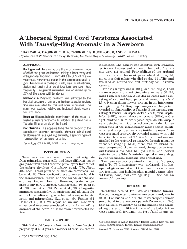 (PDF) A thoracal spinal cord teratoma associated with Taussig–Bing ...