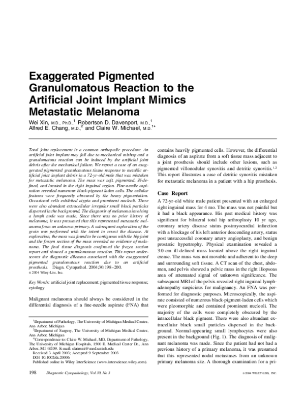 (PDF) Exaggerated pigmented granulomatous reaction to the artificial ...