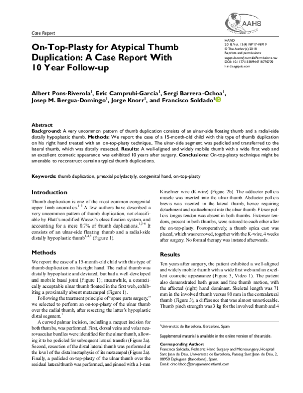 (PDF) On-Top-Plasty for Atypical Thumb Duplication: A Case Report With ...