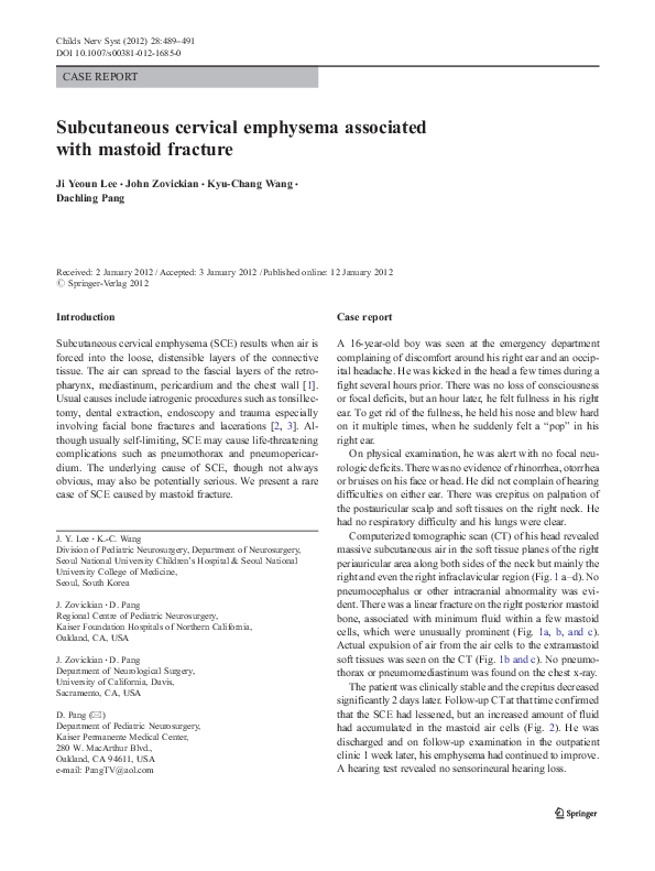 (PDF) Subcutaneous cervical emphysema associated with mastoid fracture