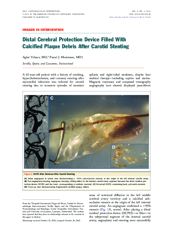 (PDF) Distal Cerebral Protection Device Filled With Calcified Plaque ...