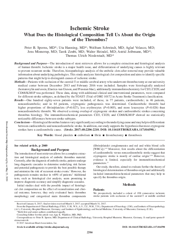 (PDF) Ischemic Stroke
