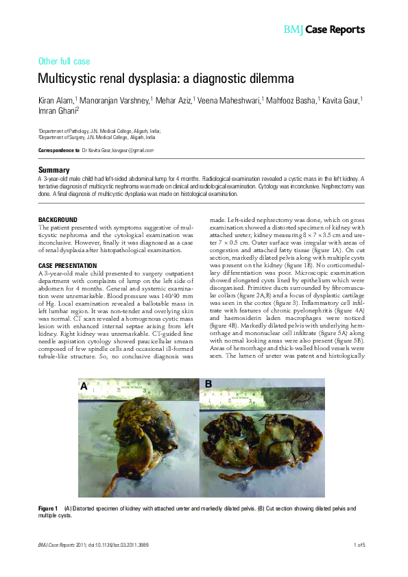 (PDF) Multicystic renal dysplasia: a diagnostic dilemma