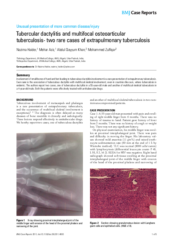 (PDF) Tubercular dactylitis and multifocal osteoarticular tuberculosis ...