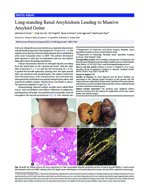 (PDF) Long-standing Renal Amyloidosis Leading to Massive Amyloid Goiter