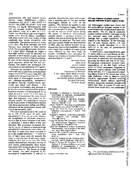 (PDF) CT scan evidence of postero-latero thalamic infarction in pure ...