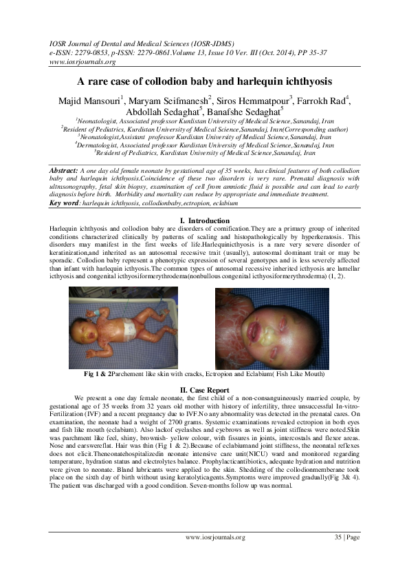 (PDF) A rare case of collodion baby and harlequin ichthyosis