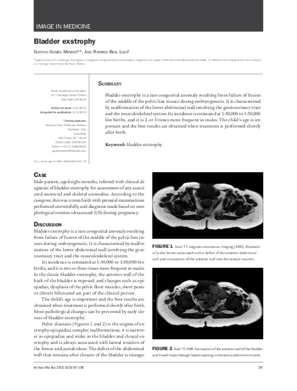 (PDF) Bladder exstrophy