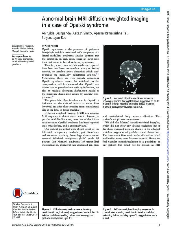 (PDF) Abnormal brain MRI diffusion-weighted imaging in a case of ...