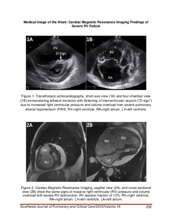 (PDF) Medical image of the week: cardiac magnetic resonance imaging ...