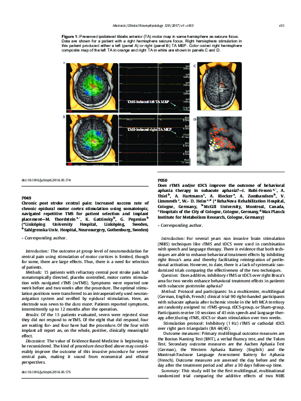 (PDF) P050 Does rTMS and/or tDCS improve the outcome of behavioral ...