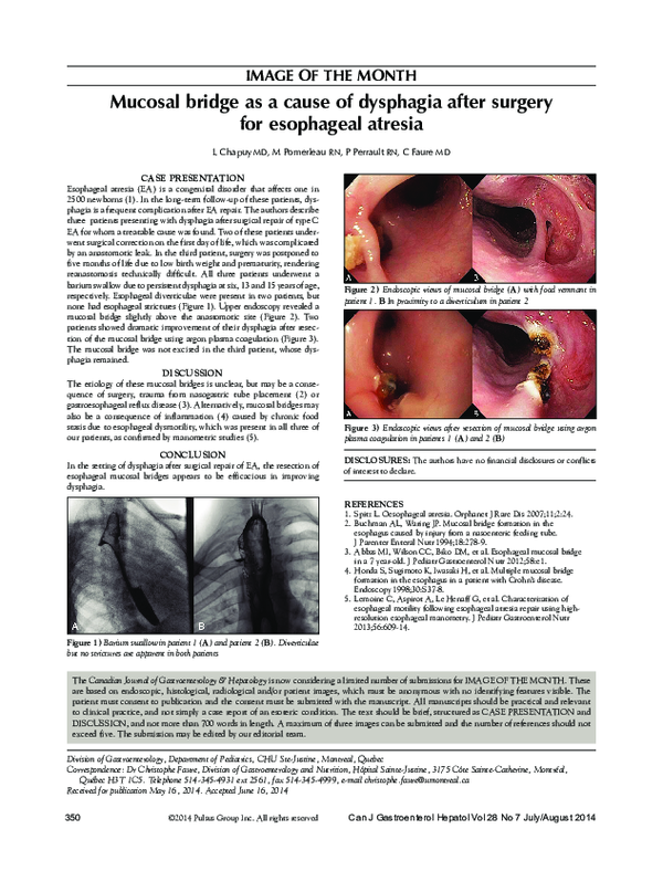 (PDF) Mucosal Bridge as a Cause of Dysphagia After Surgery for ...