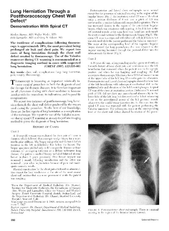 (PDF) Lung Herniation Through a Postthoracoscopy Chest Wall Defect