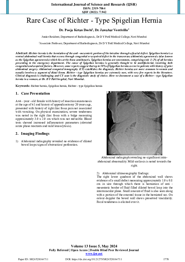 (PDF) Richter-Type Spigelian Hernia: A Rare Case Report