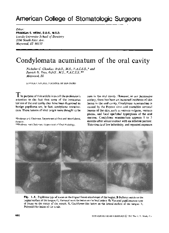 (PDF) Condylomata acuminatum of the oral cavity