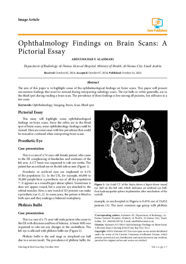 (PDF) Ophthalmology Findings on Brain Scans: A Pictorial Essay