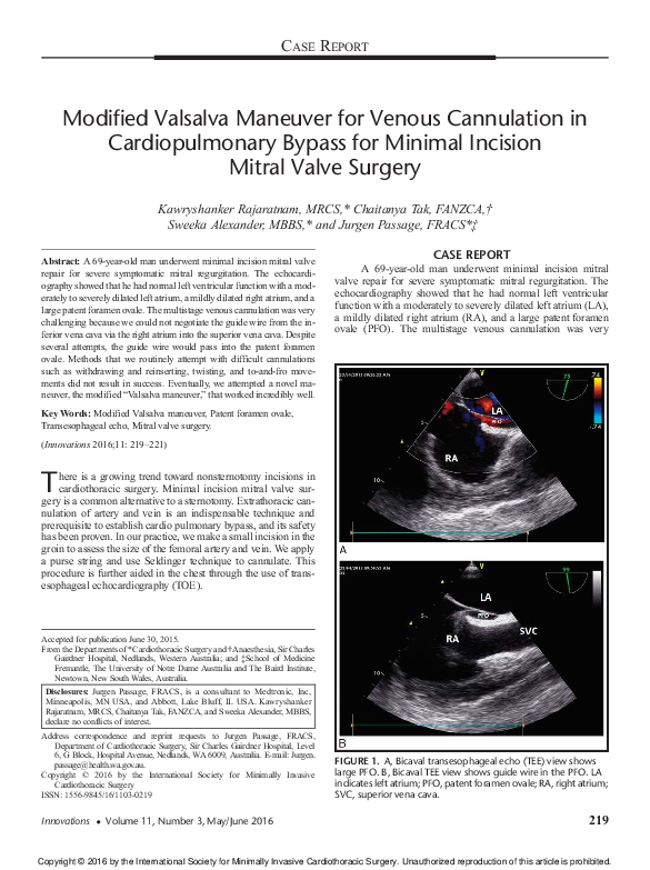 (PDF) Modified Valsalva Maneuver for Venous Cannulation in ...