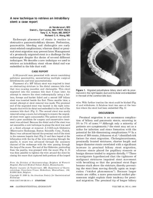 (PDF) Intrabiliary Stent Retrieval Technique: Case Report