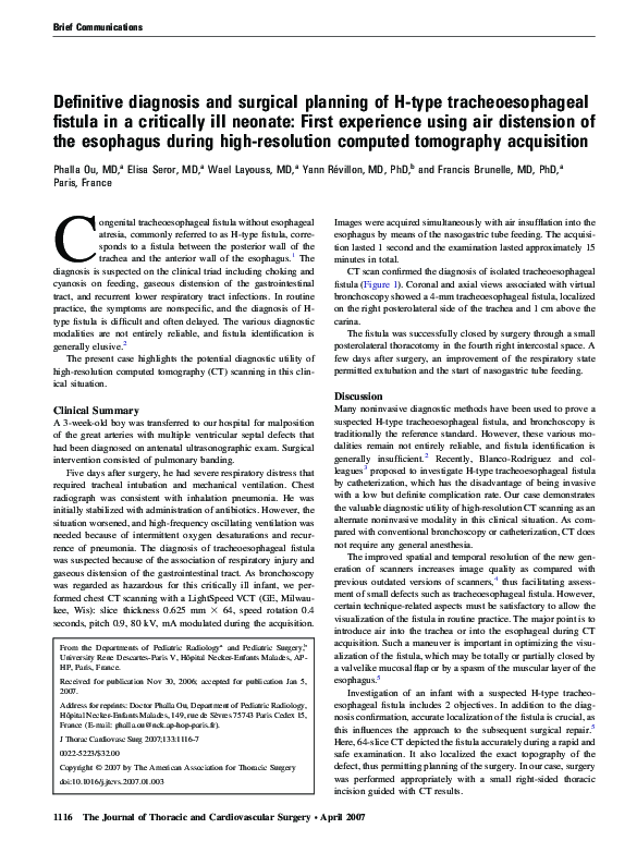 (PDF) Definitive diagnosis and surgical planning of H-type ...