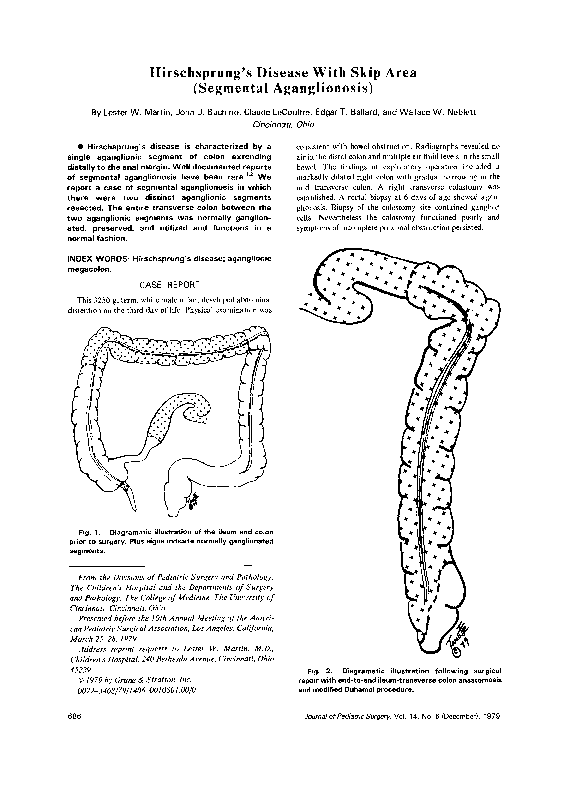 (PDF) Hirschsprung's disease with skip area (Segmental aganglionosis ...
