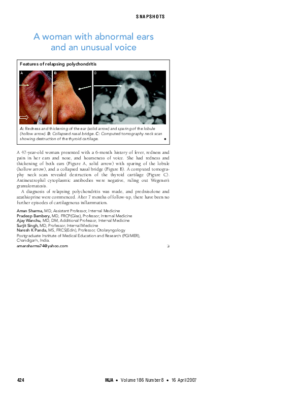 (PDF) A woman with abnormal ears and an unusual voice