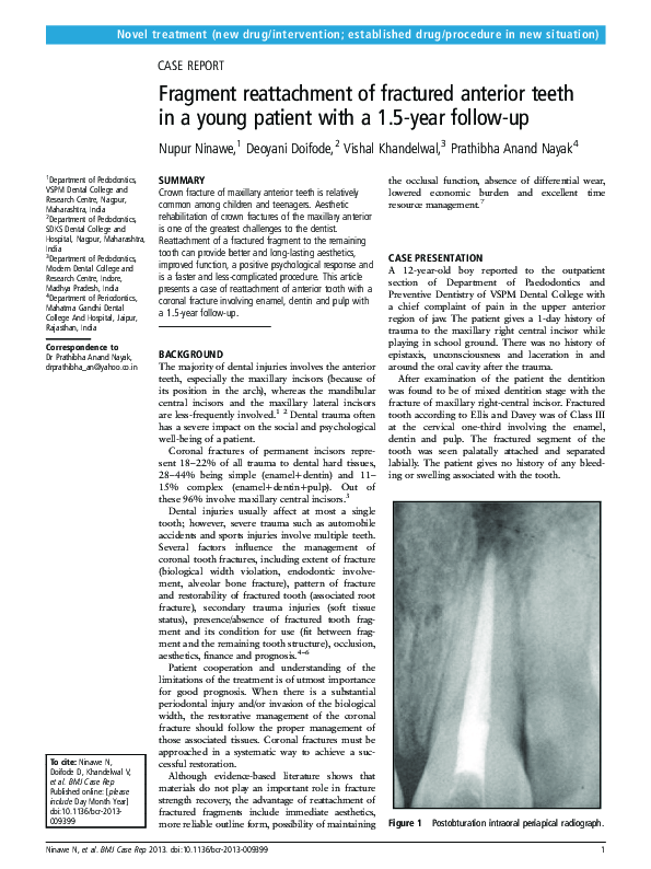 (PDF) Fragment reattachment of fractured anterior teeth in a young ...
