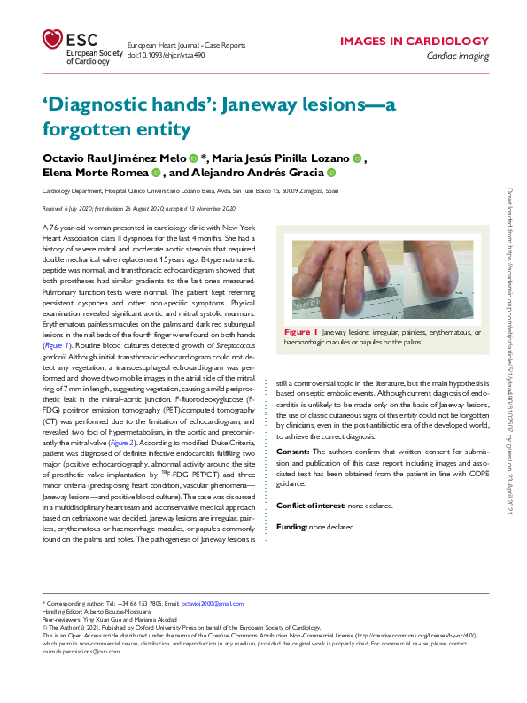 (PDF) ‘Diagnostic hands’: Janeway lesions—a forgotten entity