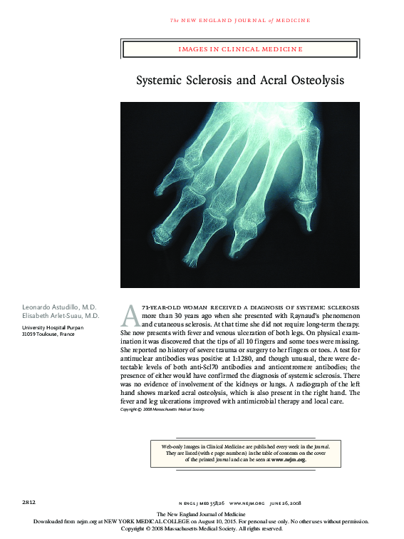 (PDF) Systemic Sclerosis and Acral Osteolysis | Leonardo Benjamin ...