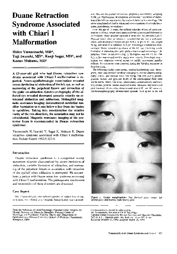 (PDF) Duane retraction syndrome associated with Chiari I malformation