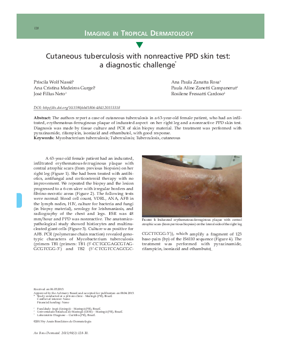 (PDF) Cutaneous tuberculosis with nonreactive PPD skin test: a ...