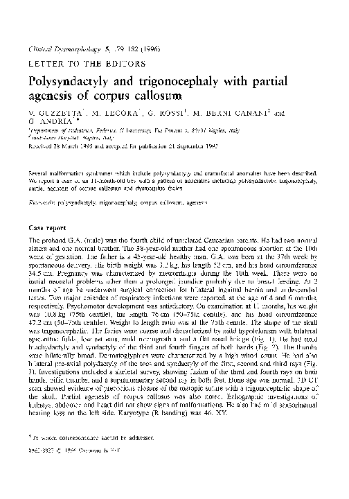 (PDF) Polysyndactyly and trigonocephaly with partial agenesis of corpus ...