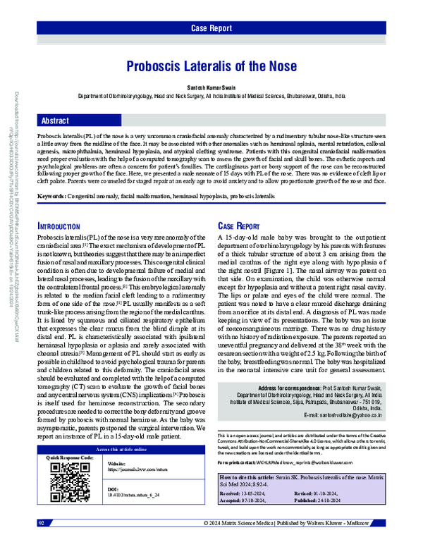 (PDF) Proboscis Lateralis of the Nose