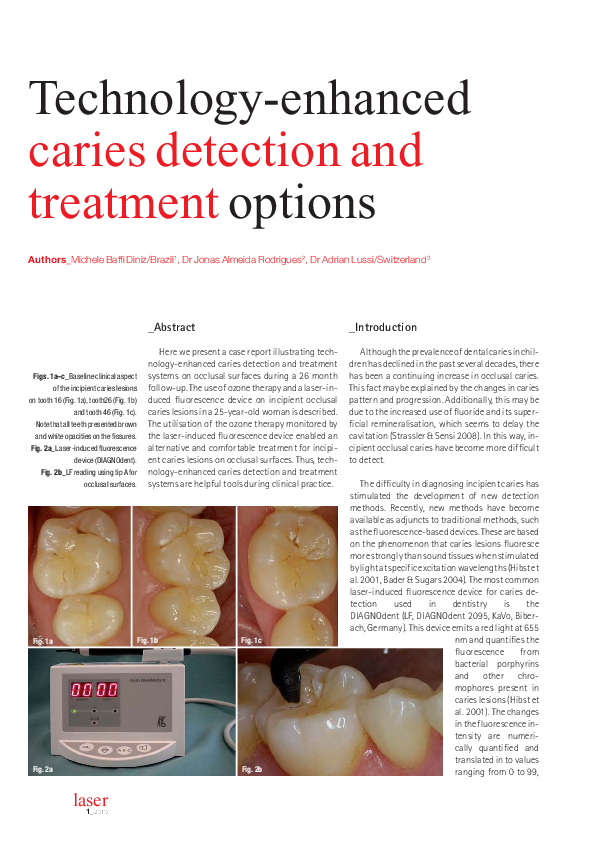 (PDF) Technology-enhanced caries detection and treatment options
