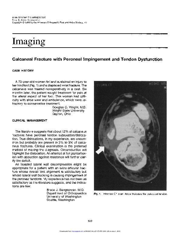 (PDF) Calcaneal Fracture with Peroneal Impingement and Tendon Dysfunction