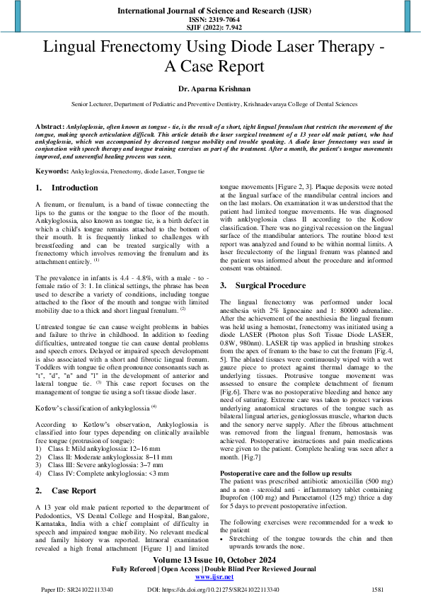 Pdf Lingual Frenectomy Using Diode Laser Therapy A Case Report