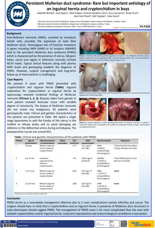 (PDF) Persistent Mullerian Duct Syndrome: Rare But Important Aetiology ...