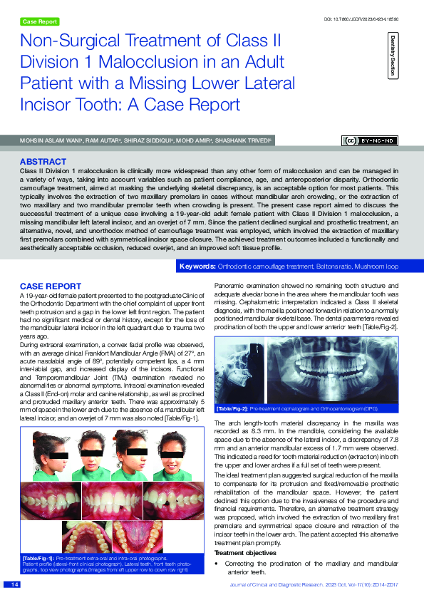 (PDF) Non-Surgical Treatment of Class II Division 1 Malocclusion in an ...