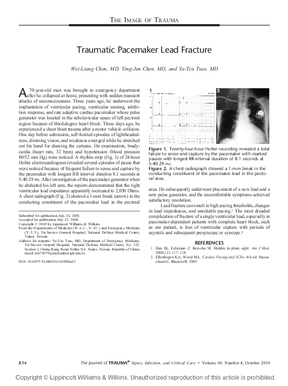 (PDF) Traumatic pacemaker lead fracture