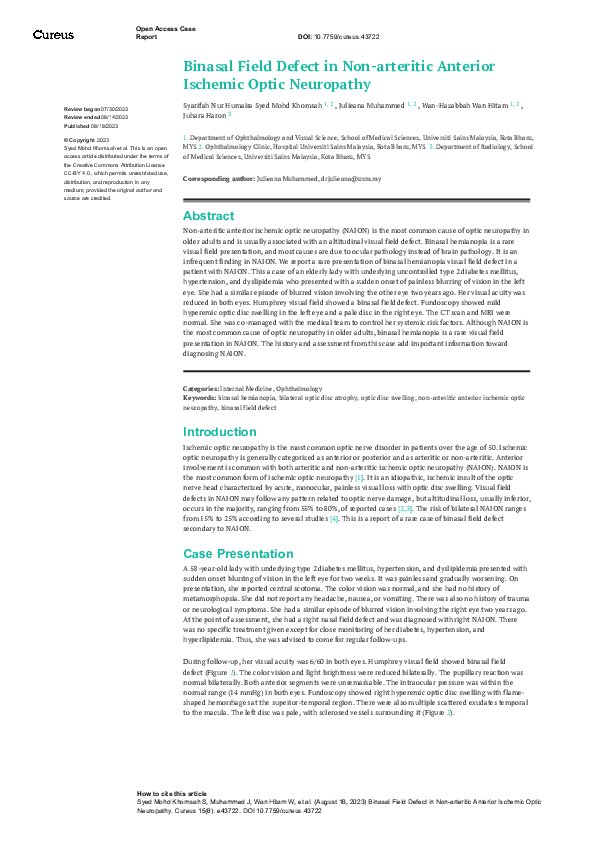 (PDF) Binasal Field Defect in Non-arteritic Anterior Ischemic Optic ...