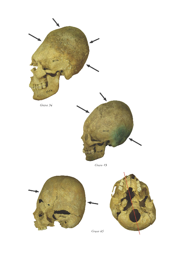 (PDF) Examples of artificially deformed skulls from the cemetery of ...