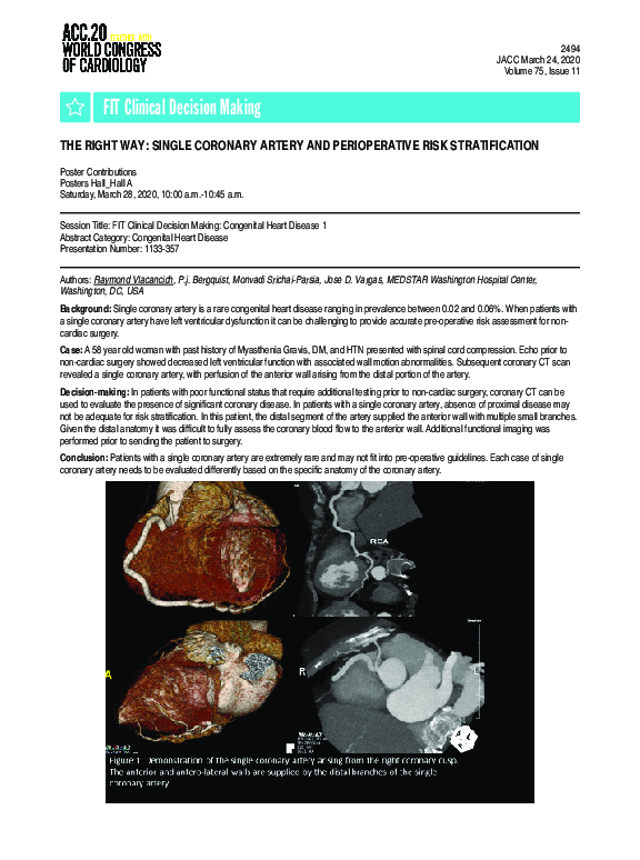 (PDF) The Right Way: Single Coronary Artery and Perioperative Risk ...