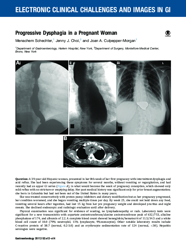 (PDF) Progressive Dysphagia in a Pregnant Woman | Menachem Schechter ...