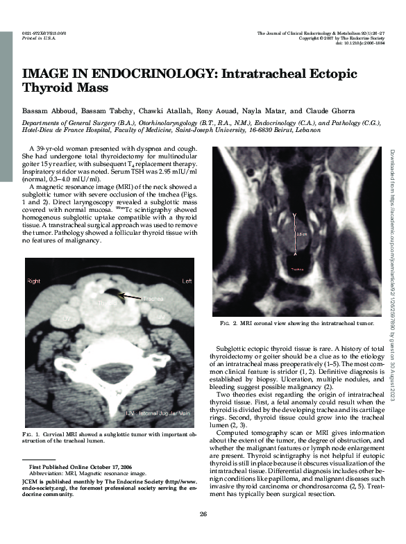 Pdf Intratracheal Ectopic Thyroid Mass Bassam Abboud