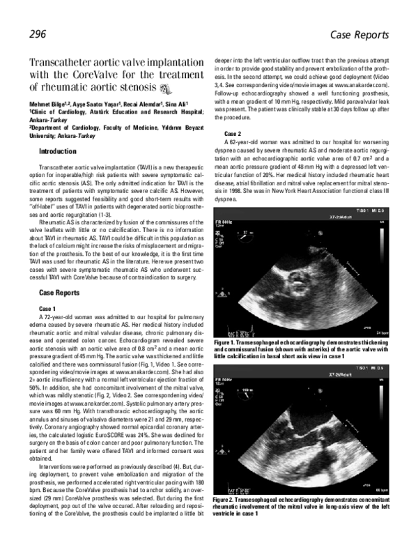 (PDF) Transcatheter aortic valve implantation with the CoreValve for ...